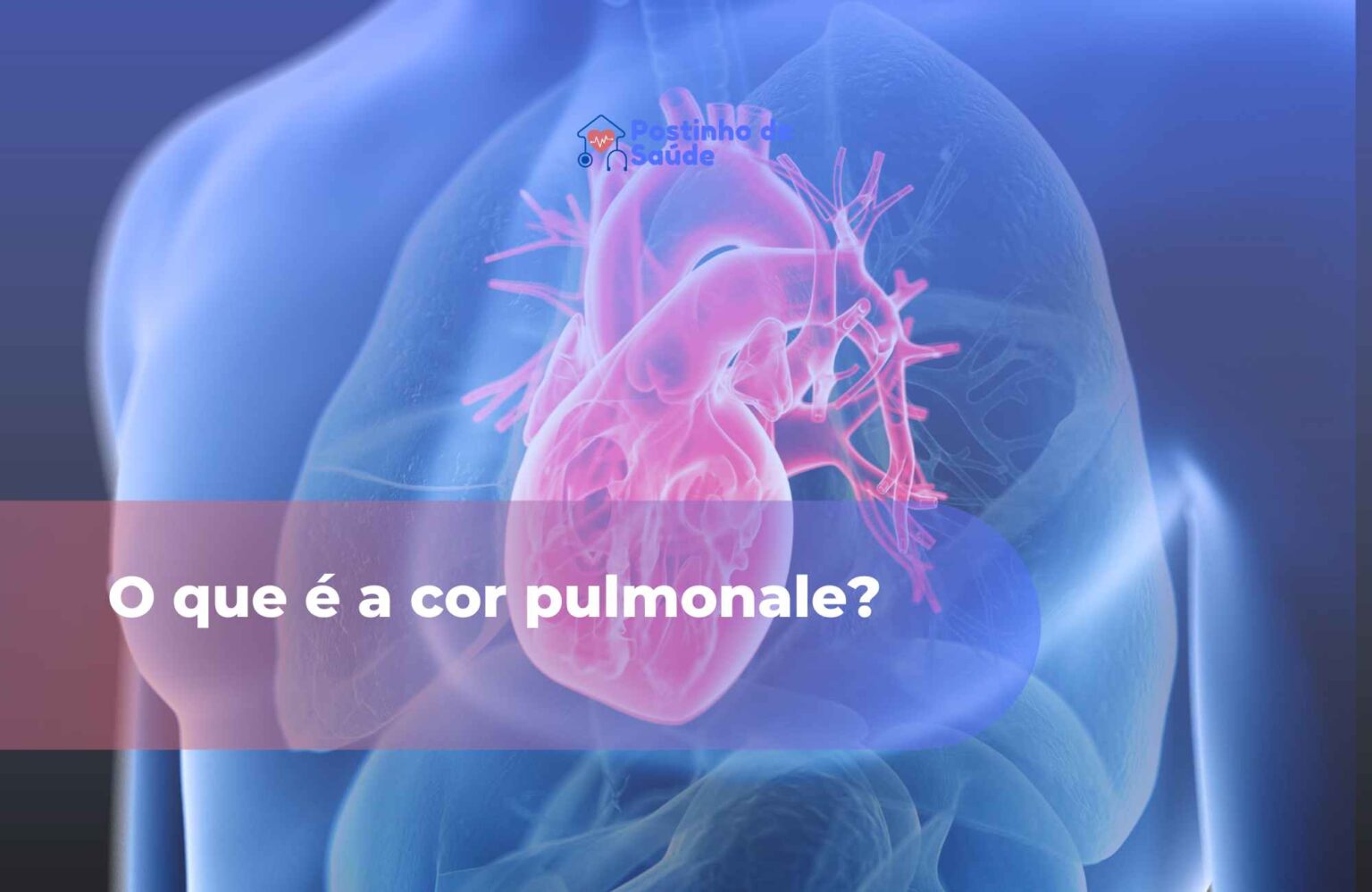 Cor pulmonale: saiba o que é e como é o tratamento